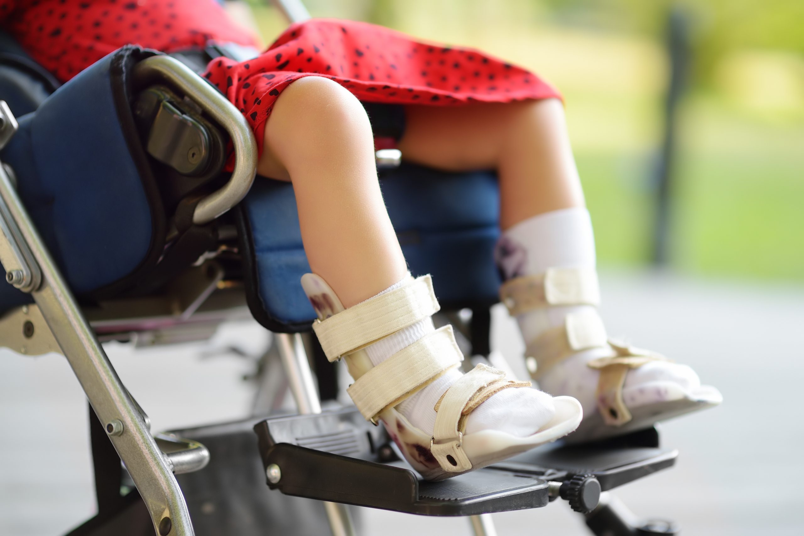 My leg is different, let’s talk about it! - Montreal Children's Hospital